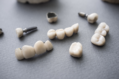 Dent nécrosée : comment traiter cette infection dentaire
